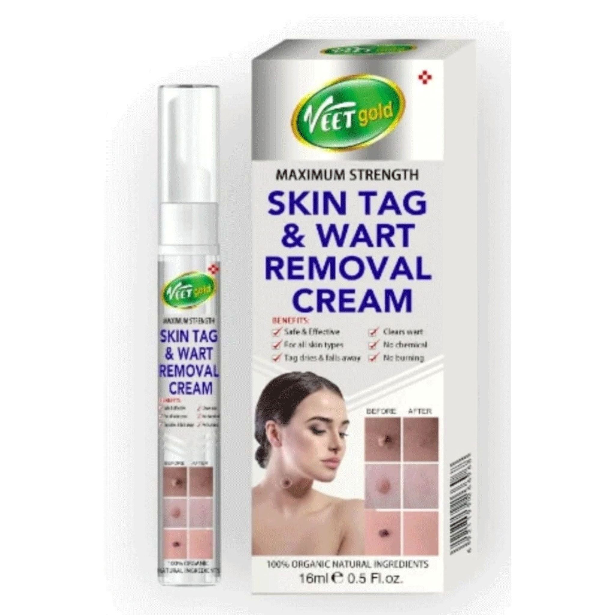 Veetgold Skin Tag Wart Removal Cream – Coccibeauty